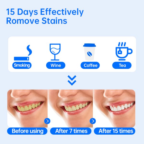 powsmart:Don’t Fall for These Viral Teeth Whitening Trends: Dentist ...